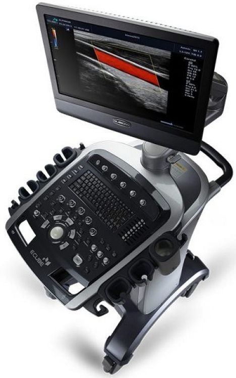 Alpinion E cube 9 Diamond Ultrasound | Ιπποκράτης Ιατρικά μηχανήματα | Ιπποκράτης Ιατρικά μηχανήματα